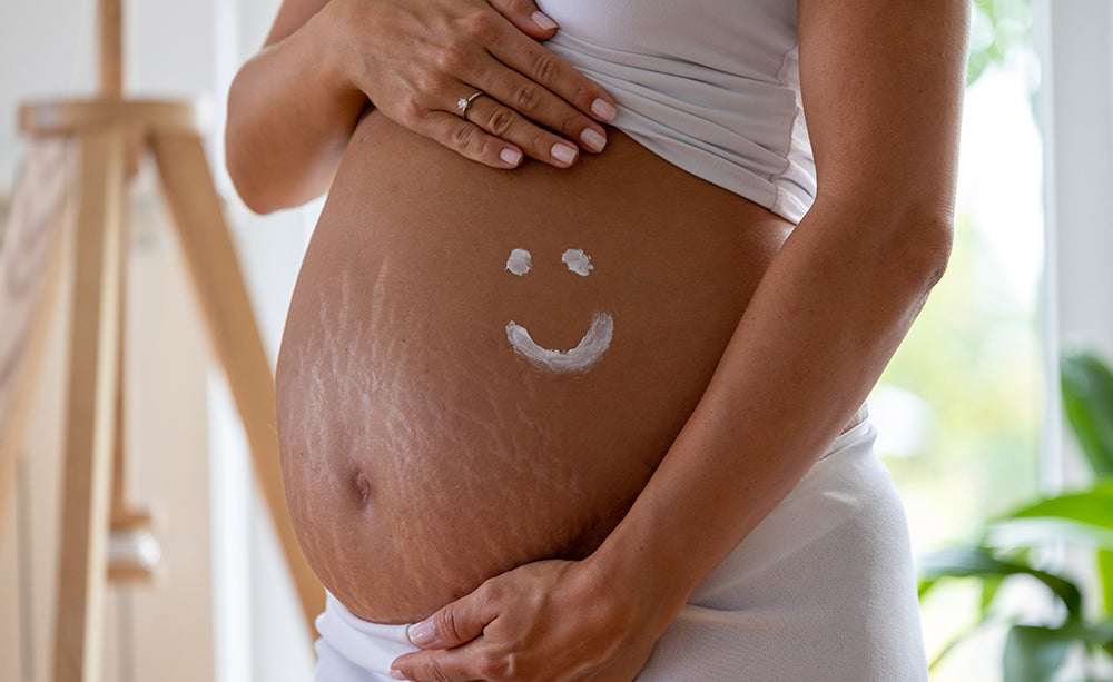 Stretch Marks & Body Positivity - Embracing Your Skin’s Journey – Trilastin